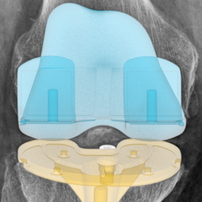 Imaging Core Lab Services for Medical Device Trials | RAYLYTIC