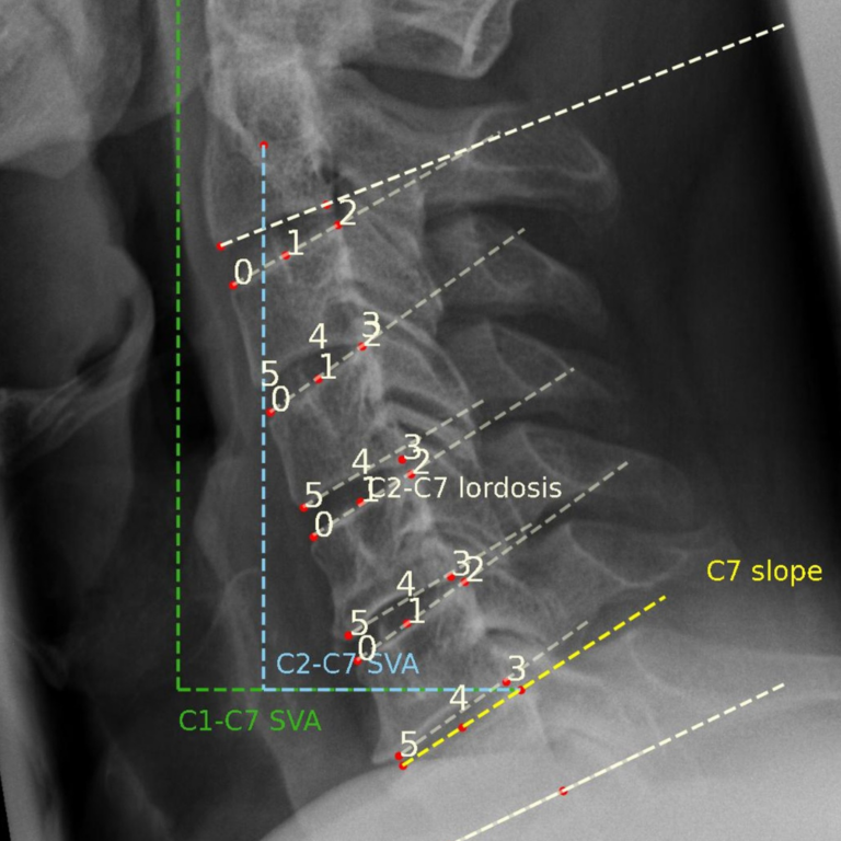 Imaging Core Lab Services for Medical Device Trials | RAYLYTIC
